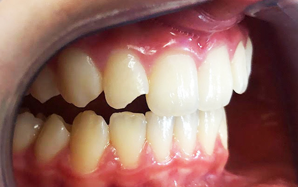 Περιστατικά - dentality.gr