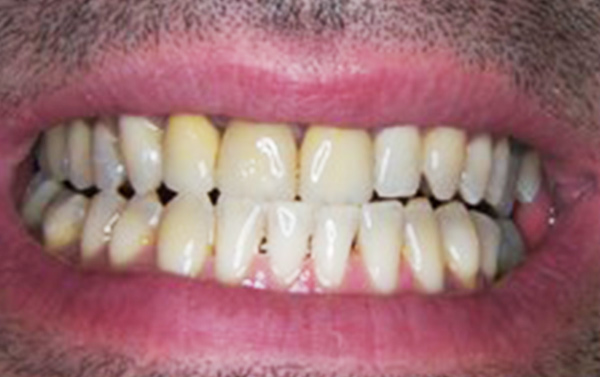 Περιστατικά - dentality.gr