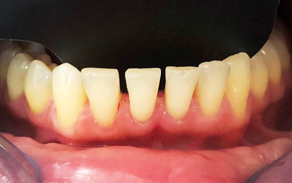 Περιστατικά - dentality.gr