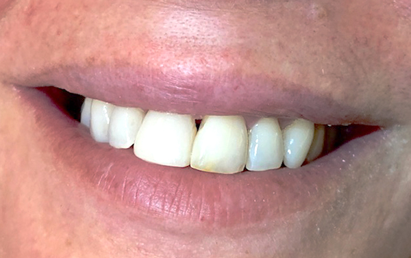 Περιστατικά - dentality.gr