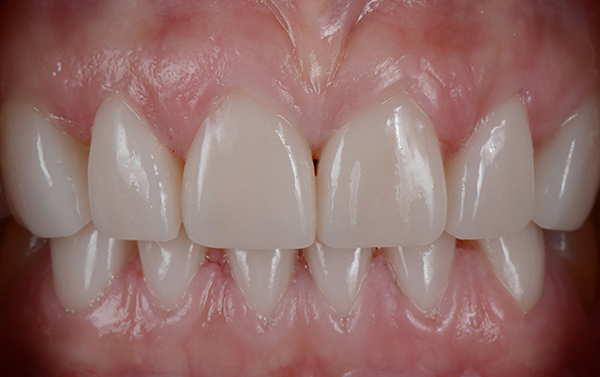 Περιστατικά - dentality.gr