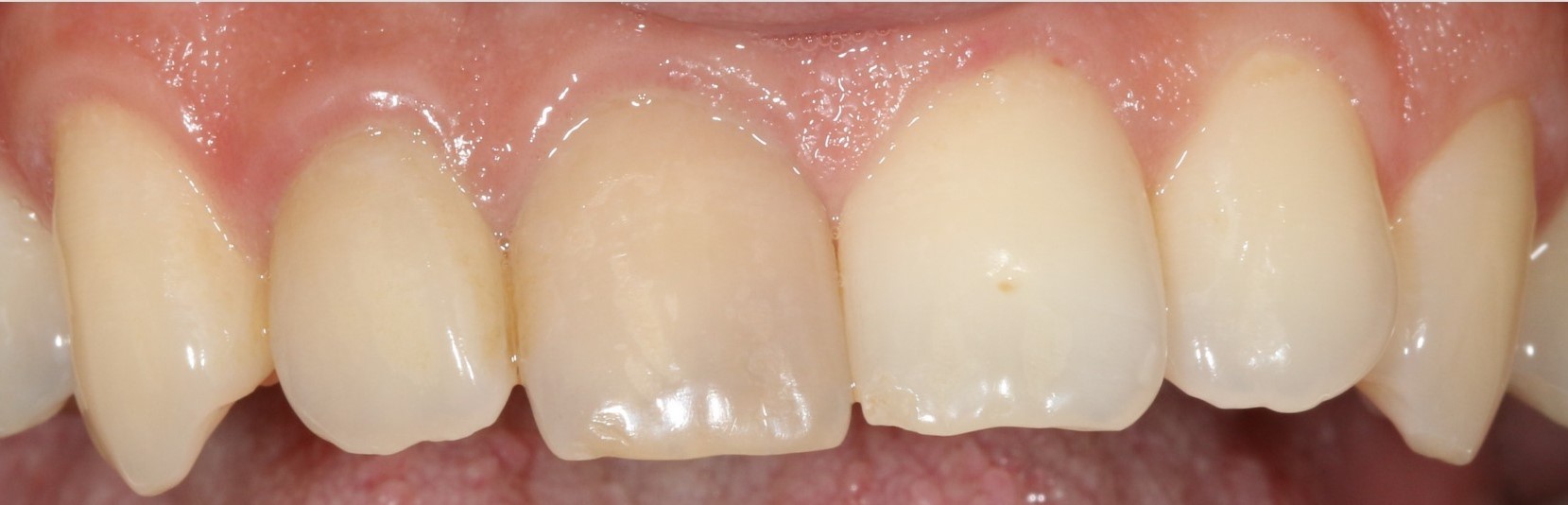 Περιστατικά - dentality.gr